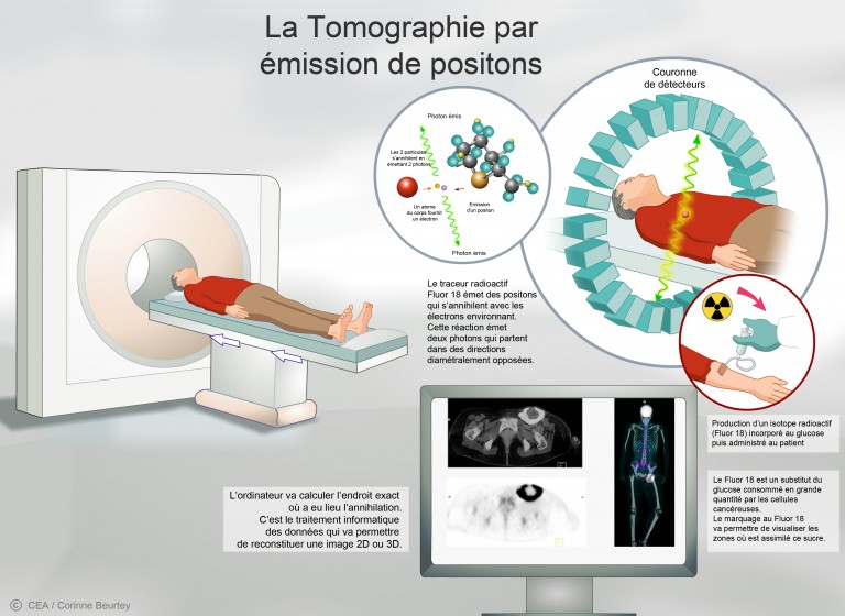 Schema - TEP - Les Cèdres - Centre de Médecine Nuclaire